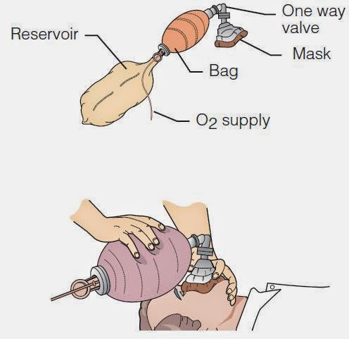 Bag-Valve Mask (BVM) ~ Nursing