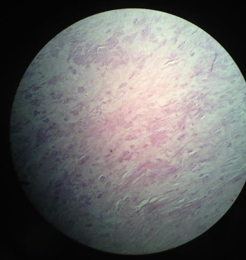 atlas de histología: TEJIDO CARTILAGINOSO