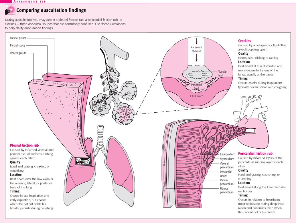 An Unexpected Error: Living without a Pericardium