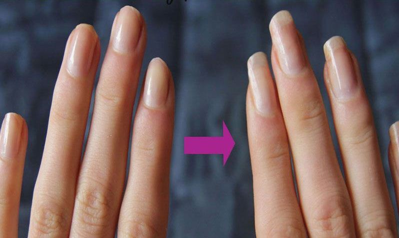How to Grow Your Nails Faster in Just 1 Week