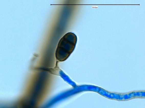 Fun With Microbiology (What's Buggin' You?): July 2015