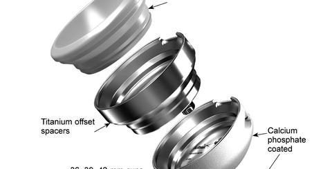 UW Shoulder and Elbow Academy: Reverse total shoulder - scapular ...