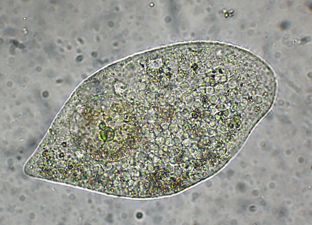 Il Microscopio: VARI CILIATI