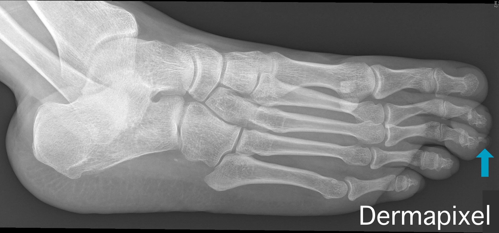 Dermapixel: abril 2021