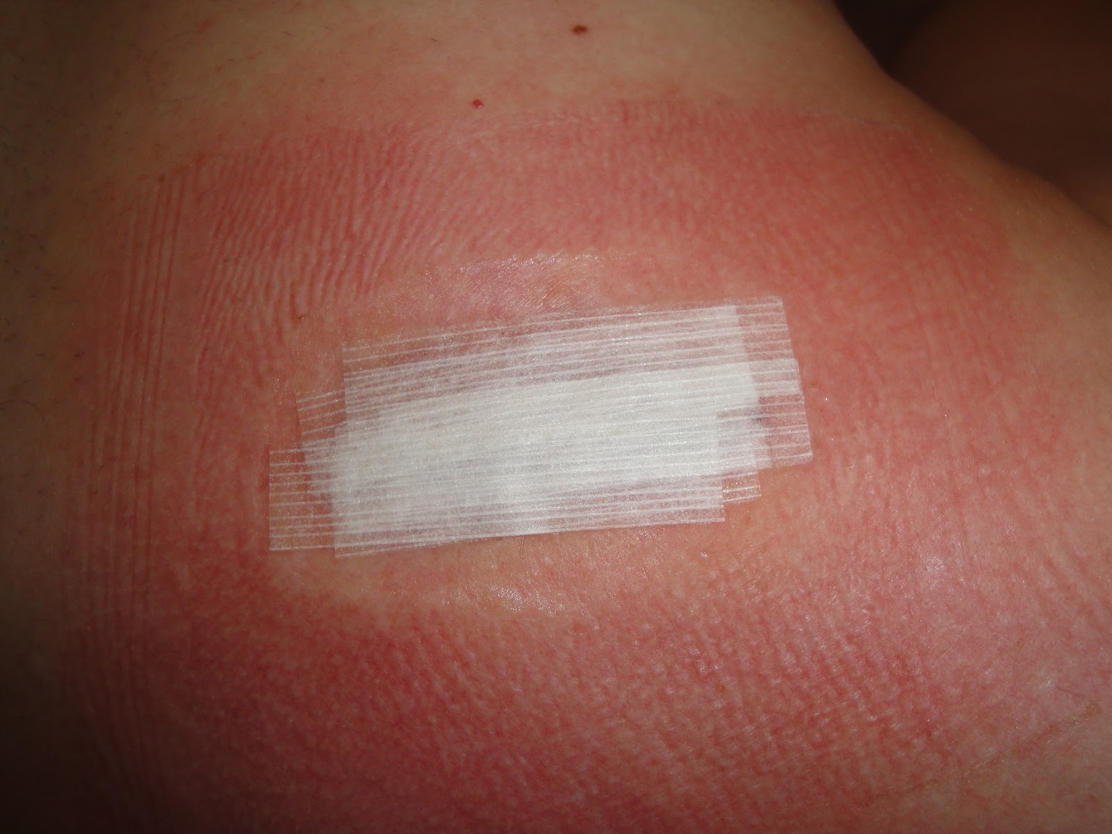 Fight It, Survive It