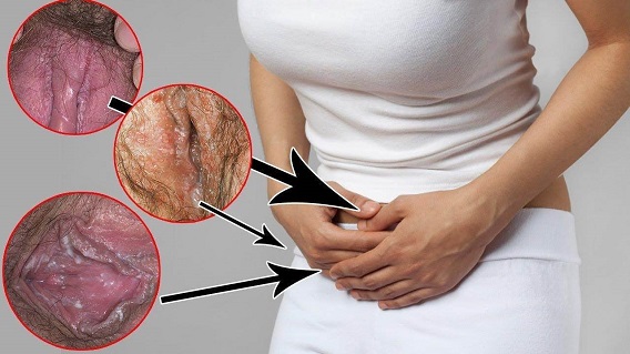 HEALTH ALL YOU NEED TO KNOW ABOUT VAGINA INFECTION Love Story Book health-all-you-need-to-know-about-vagina-infection-love-story-book