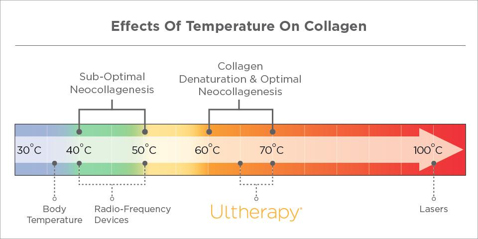 Nana Dermatology #2: HIFU laser treatments - Shurink vs. Ulthera!