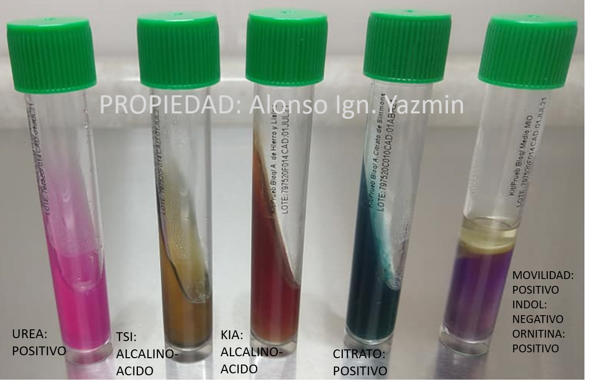 Bioquímica Diagnóstica BQD-YAI: Proteus mirabilis