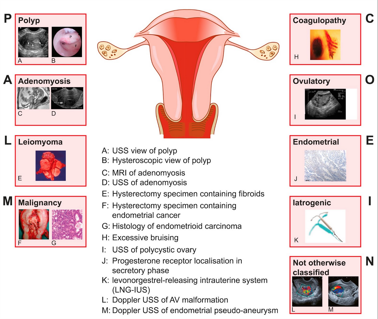 Abnormal Uterine Bleeding in Reproductive Aged Women