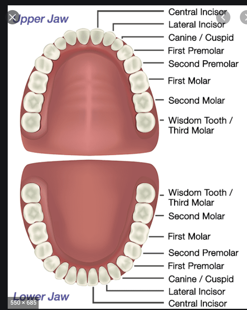 Carmen: Braces- Tooth Extraction