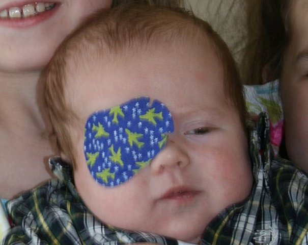 Tommy's Eyes: Fun Eye Patches