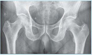 Estudios radiográficos que comprenden miembros inferiores y superiores ...