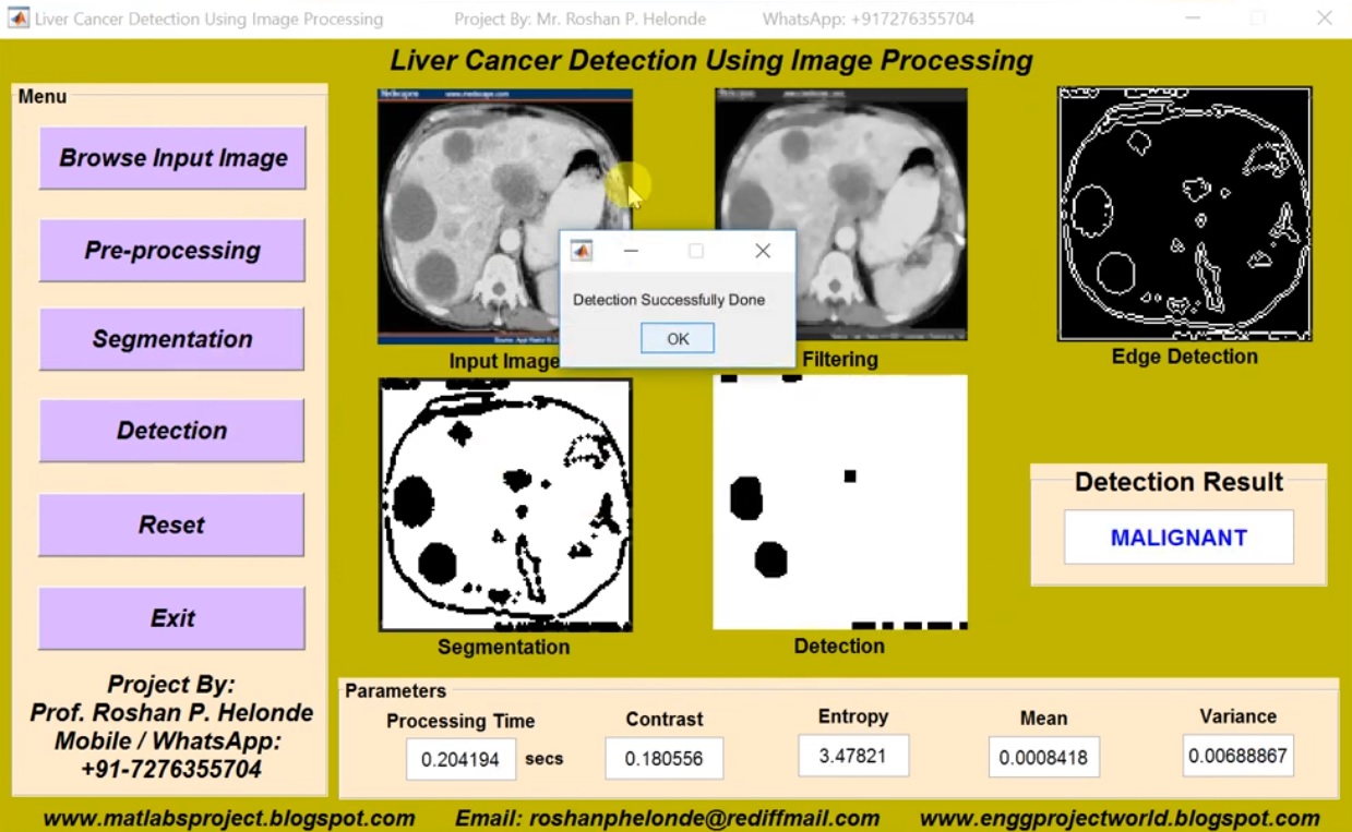 Matlab Code For Liver Cancer Detection Using Image Processing Full