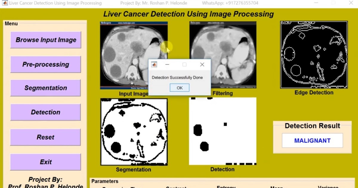 Matlab Code for Liver Cancer Detection Using Image Processing Full ...