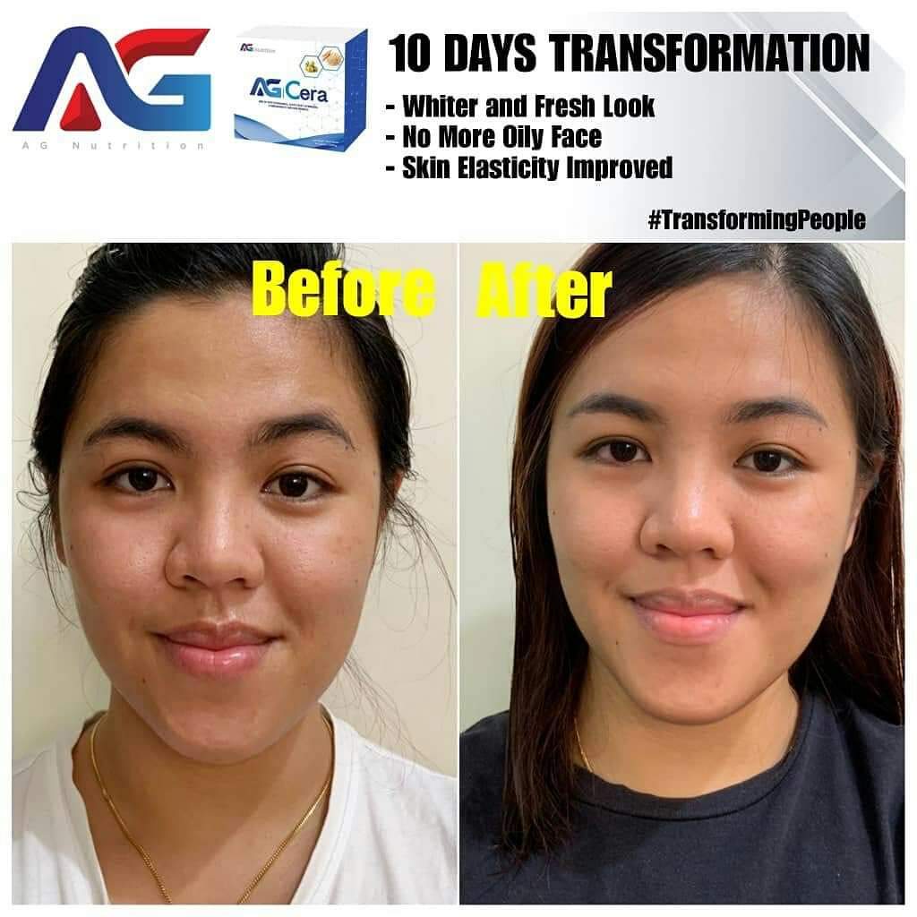 AG CERA | KULIT KEMBALI CERAH MUDA SEPANTAS 7 HARI!