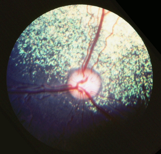 Taco Belle Times: "Tails" of a Baby Boomer Veterinarian: RETINAL ...