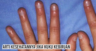 Ternyata, Bentuk Dan Warna Kuku Menunjukkan Kesehatanmu | zeropromosi | souvenir barang promosi ...