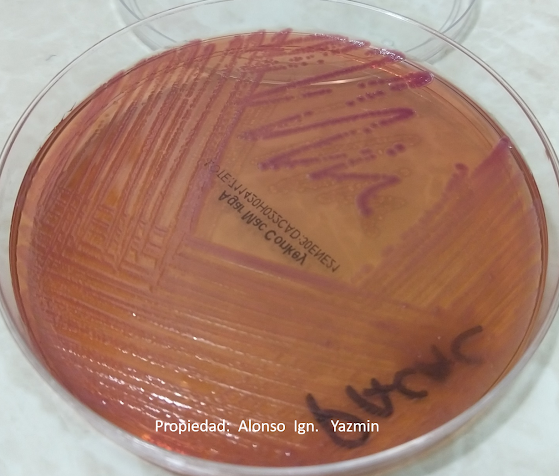 Bioquímica Diagnóstica BQD-YAI: Yersinia enterocolitica