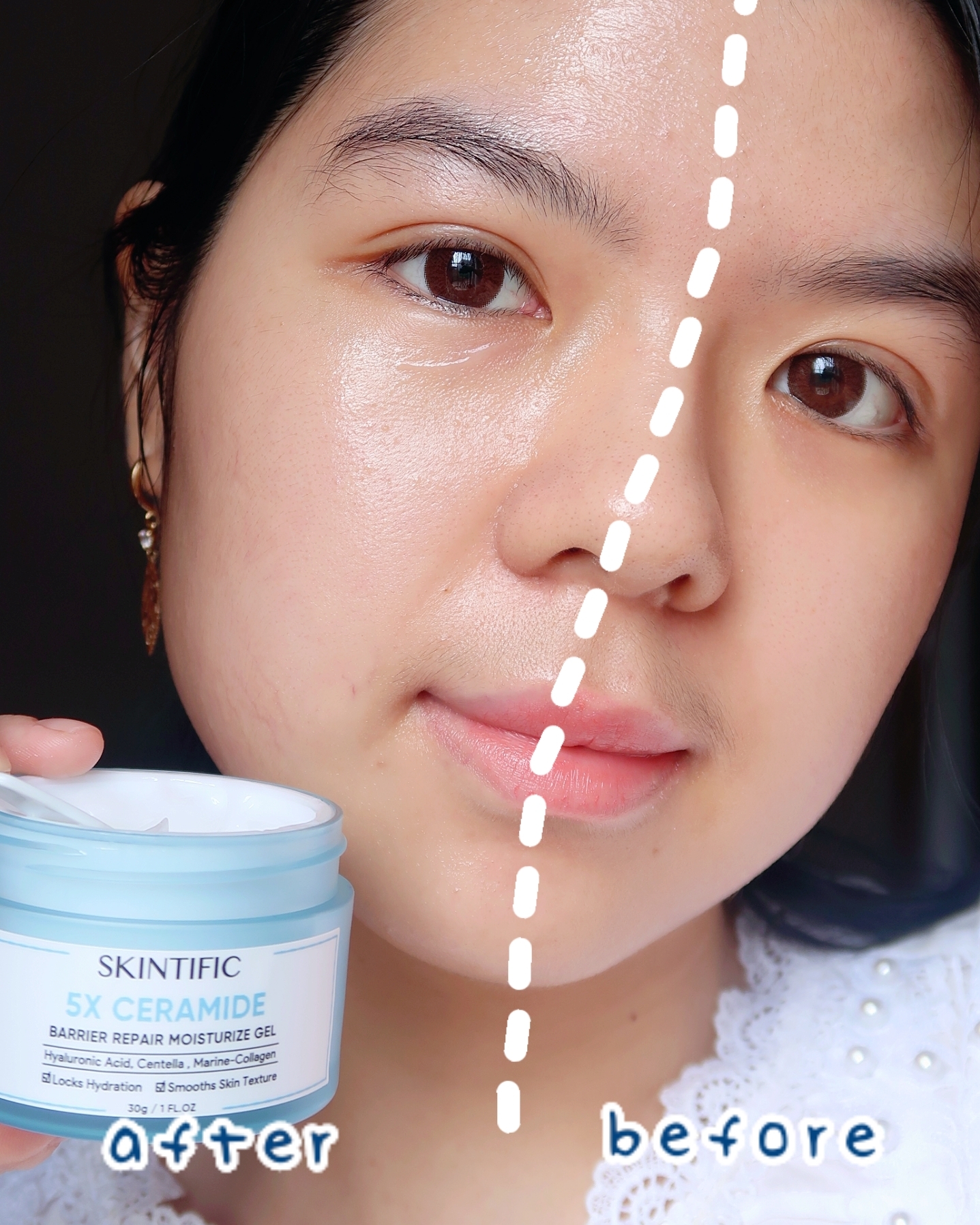 Skintific 5X Ceramide Barrier Repair Moisture Gel Review | Moisturizer ...