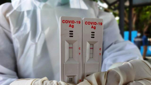 Manual Prosedur Rapid Test COVID-19 Antigen Kaset COV-TEST