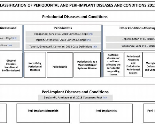 New classification of periodontal and peri-implant diseases