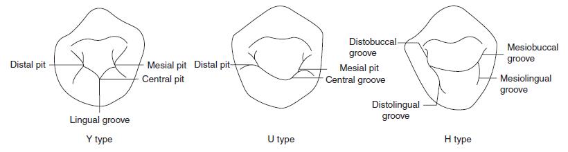 Permanent mandibular premolars l tooth crown & root morphology MCQs for ...