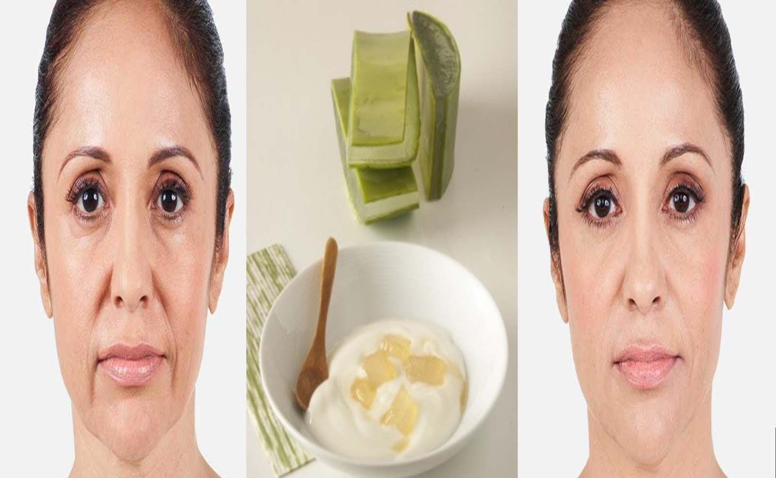 Comment rehausser les joues affaissées avec des remèdes naturels