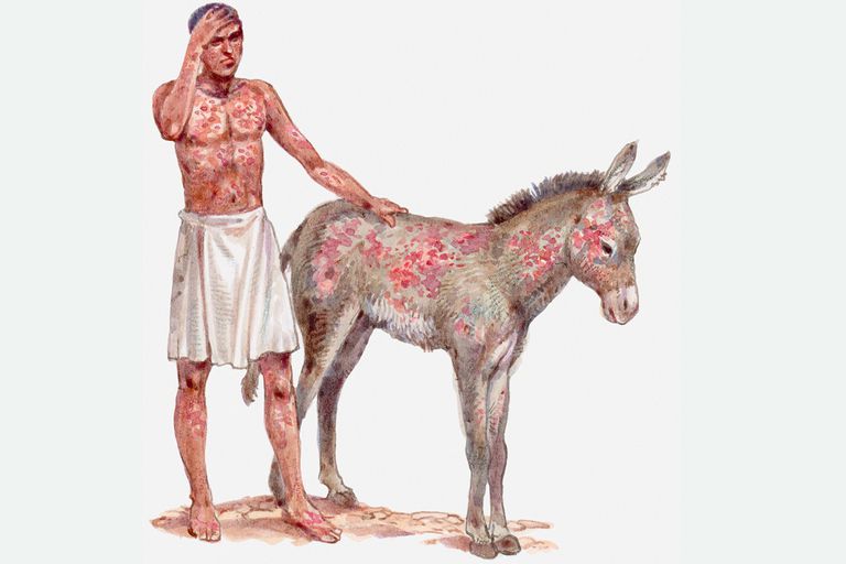 Fred Widdowson's Blog: Exodus 9:8-12 comments: boils on man and beast