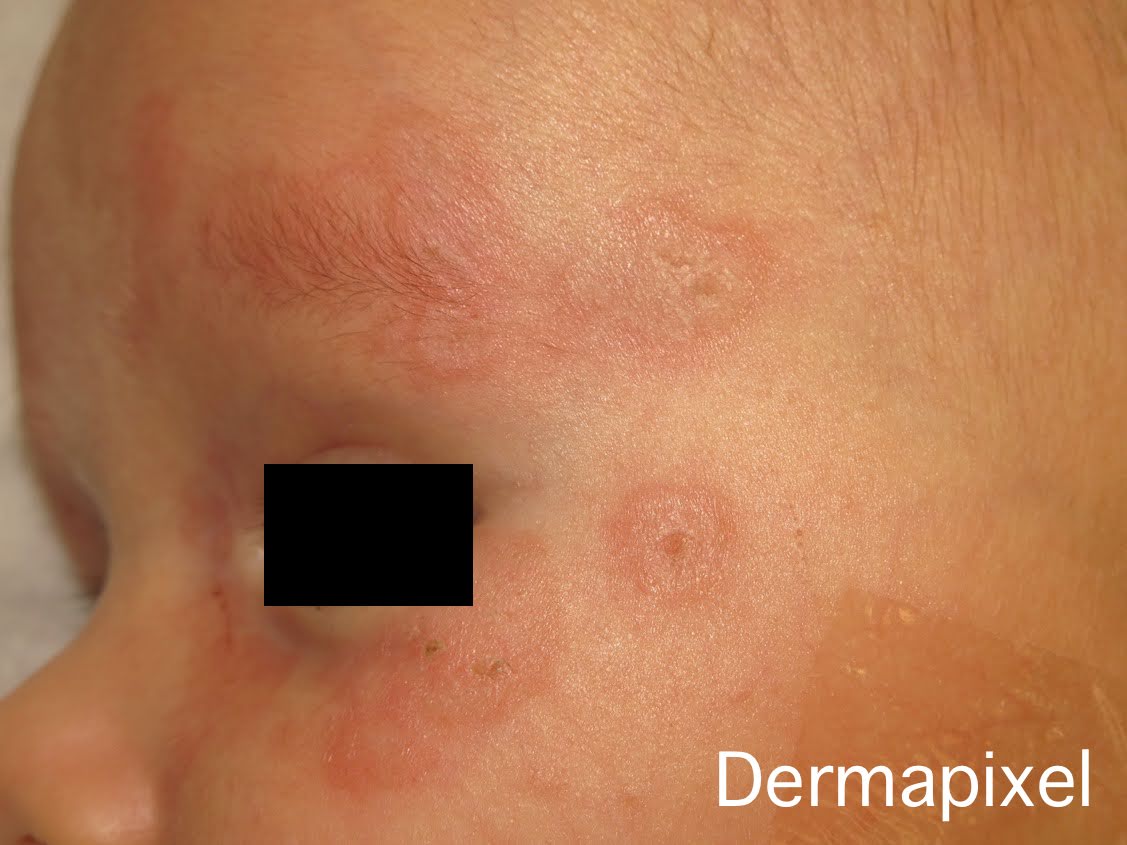 Dermapixel: diciembre 2019