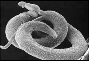 Bio Ciência: Exemplos de Platelmintos