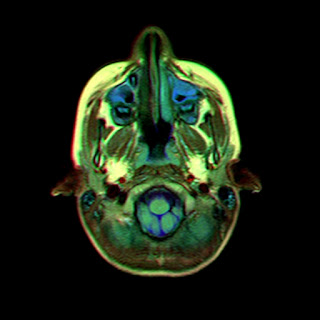 Nevit's blog: Color MRI of the Brain