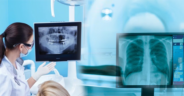 Impact On Computed Radiography With The Advent of Digital Radiography