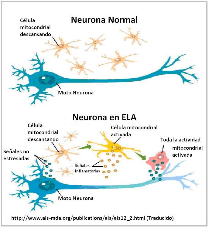 Asociación Colombiana de Neurología: Generalidades de la Esclerosis ...