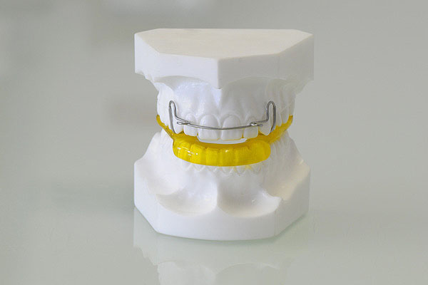 Dentistry and Medicine: Functional appliances-Orthodontic Lecture note