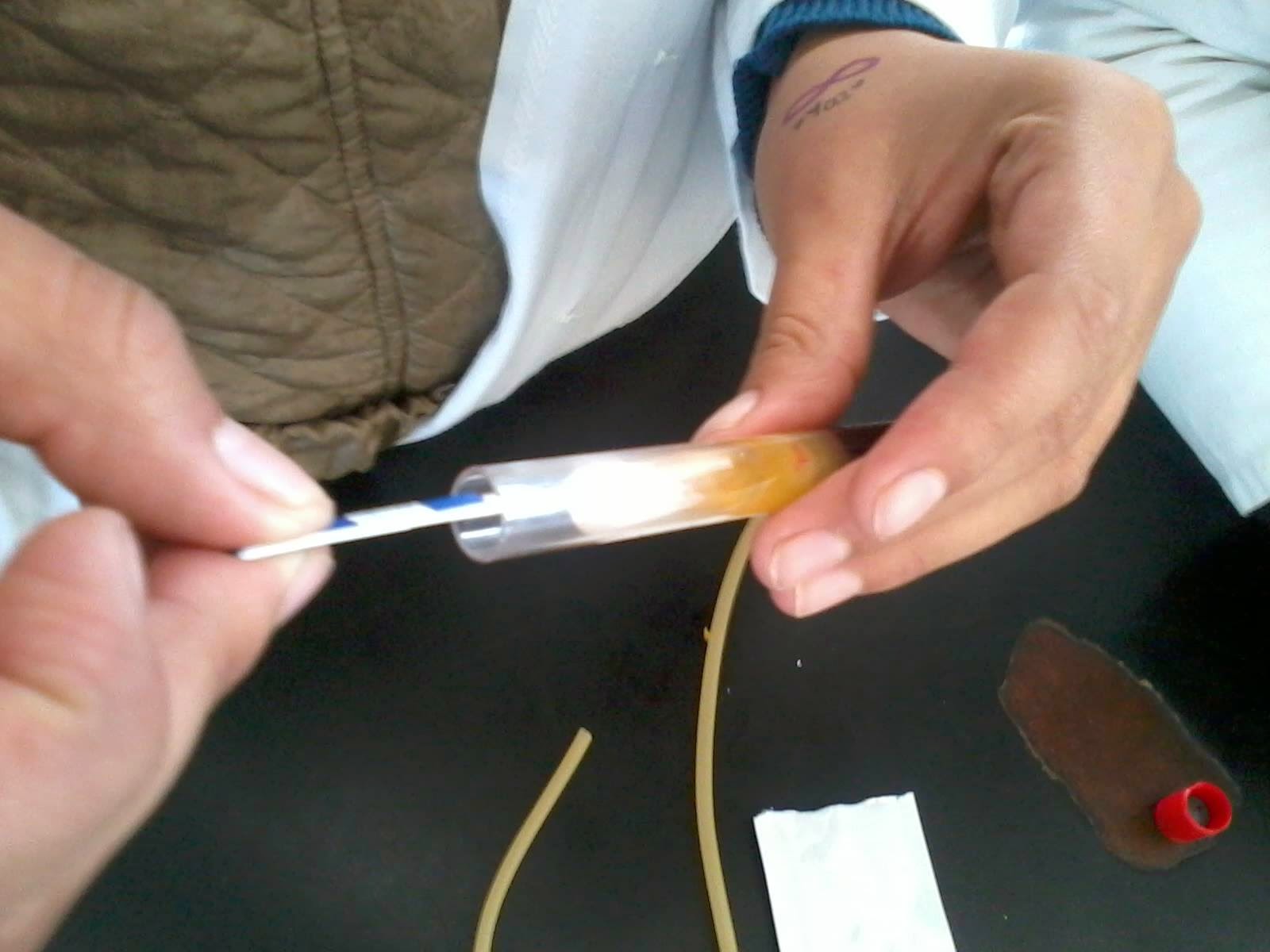 Practicas: Técnica de Willis