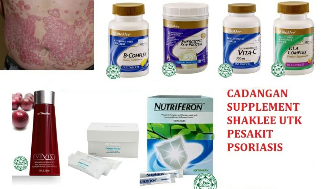 VITAMIN KU SIHAT: PSORIASIS SAKIT KULIT YANG MENYAKITKAN