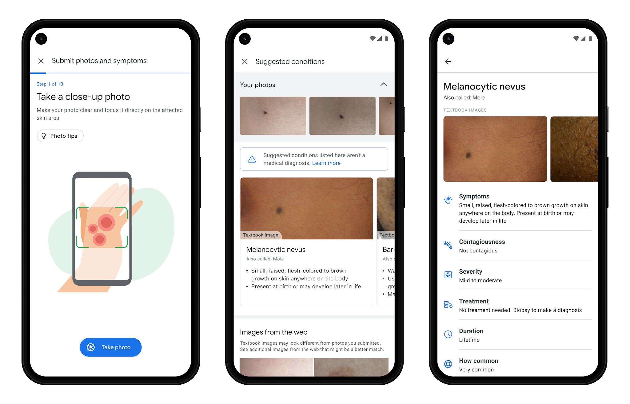 Google Will Now Play Doctor with You by Diagnosing Your Skin Conditions!