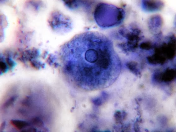 Fun With Microbiology (What's Buggin' You?): Entamoeba polecki