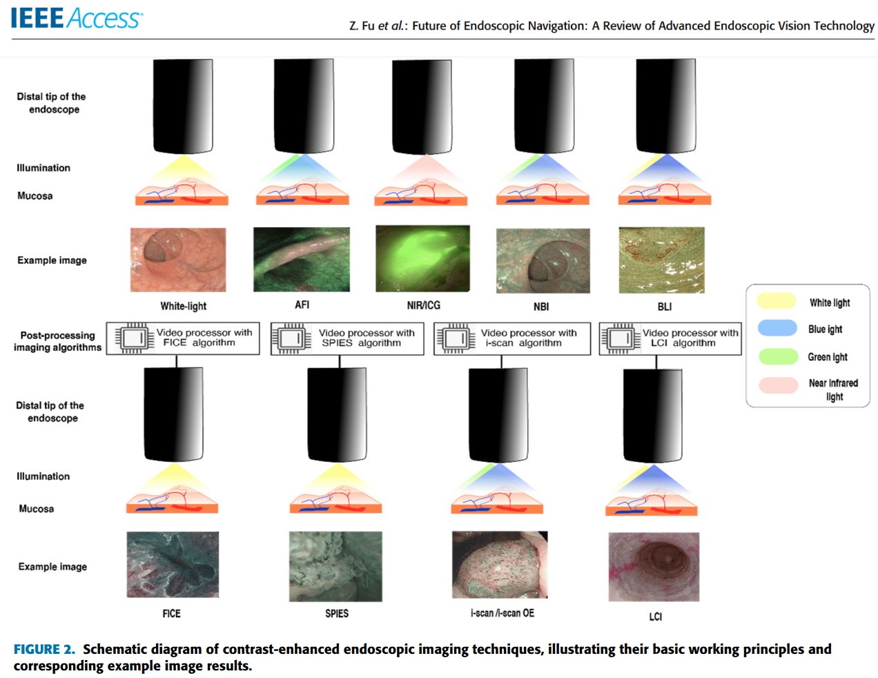 Article intro - The Future of Endoscopic Navigation