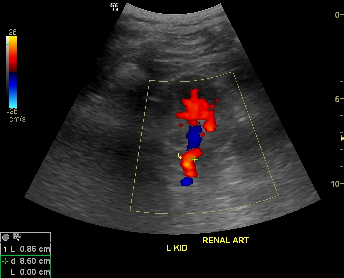 cochinblogs: Normal renal arterial color doppler study