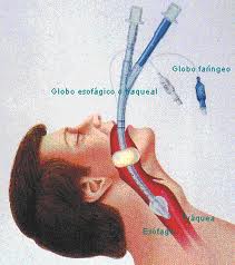 terapia intensiva: PROCEDIMIENTO DE INTUBACION