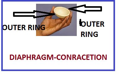 MAS PHARMACY REVIEW-HEALTH TIMES: CONTRACEPTION-BARRIER METHODS