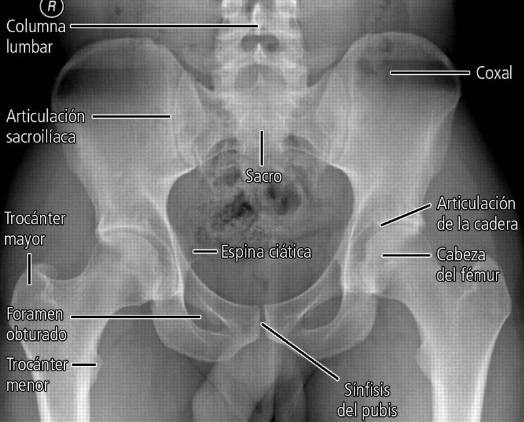 MMII-ARTICULACION COXOFEMORAL-RX FRENTE