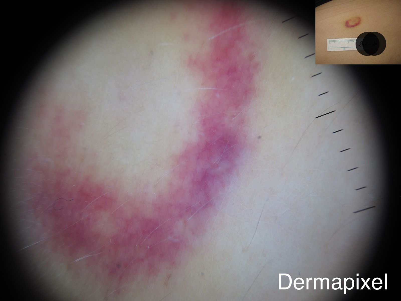 Dermapixel: mayo 2018