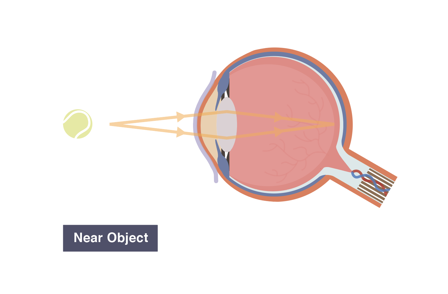 IGCSE Biology 2017 2 92 Understand The Function Of The Eye In igcse-biology-2017-2-92-understand-the-function-of-the-eye-in