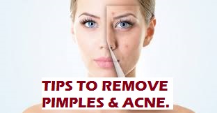 4 TIPS TO GET RID OF PIMPES ON FOREHEAD. ~ HEALTHYTIP.IN