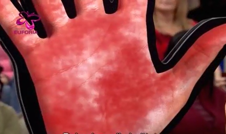 Emisiuni Oz: Doctor Oz: Obezitatea provoaca si cancer! Ce ne "spune" palma