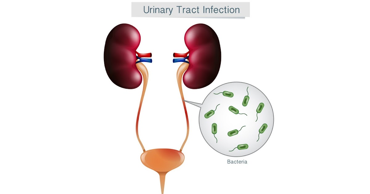 Men’s Health - Urinary Tract Infection (UTI)
