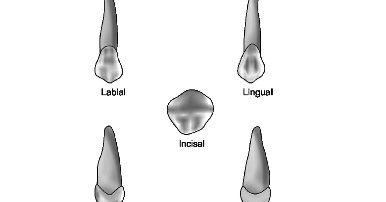 Permanent canines l tooth crown & root morphology MCQs for dental ...