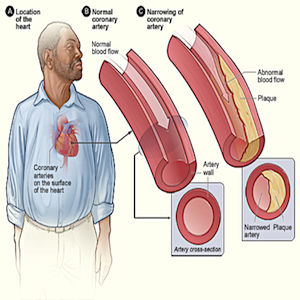 Top 6 Artery Cleansing Foods